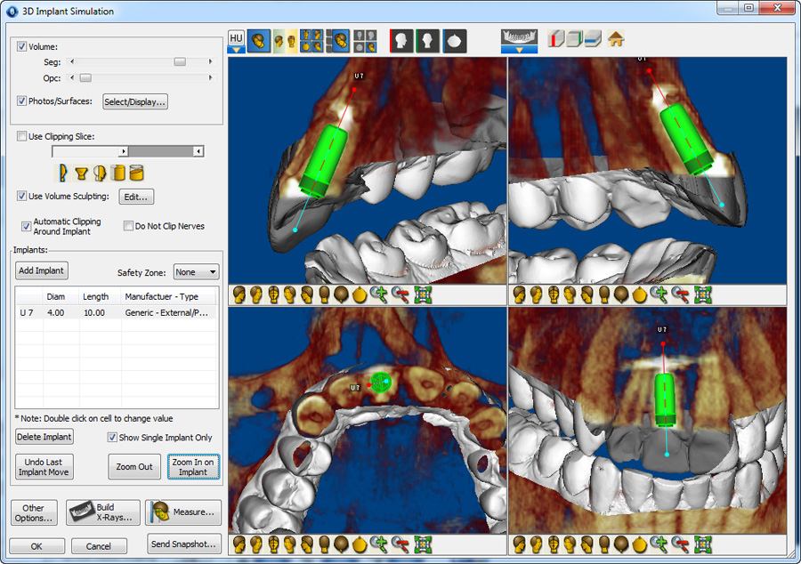 Dolphin imaging microsoft office - xasercover