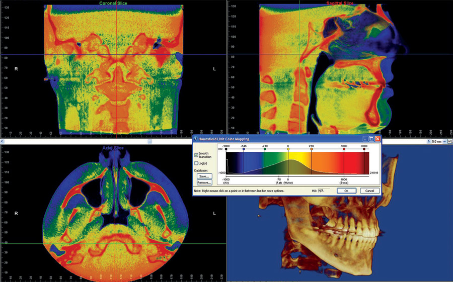 3D | Imaging and 3D Imaging | Orthodontic Imaging and Practice ...